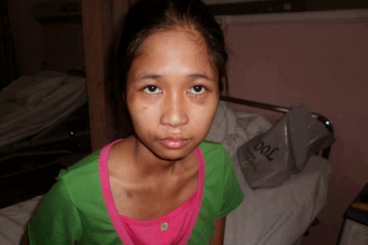 Pinay domestic worker survives jump from 3rd floor to escape abuse ...