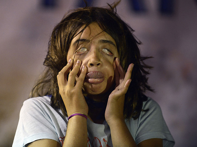 Ugly Face Pictures Images And Stock Photos Istock